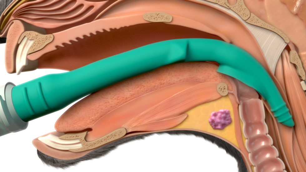 Tubo Endotraqueal V Gel Advanced MCViso tubo-endotraqueal-v-gel-advanced-mcviso